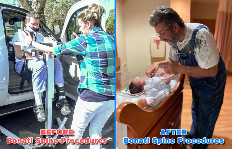 JeffD_Bonati_Before-After_1 | Bonati Spine Institute